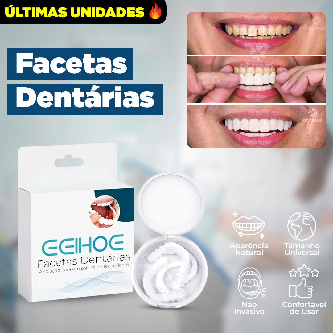 Facetas Dentárias Naturais Removíveis (Superior e Inferior) - SmileFit